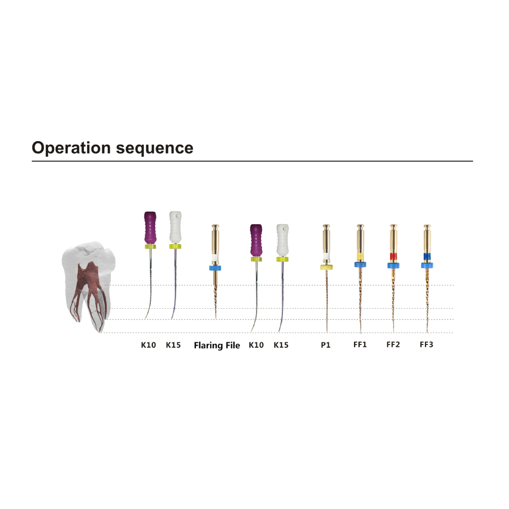 Set ace rotative Ni-Ti DENJOY i3Gold – Denttech